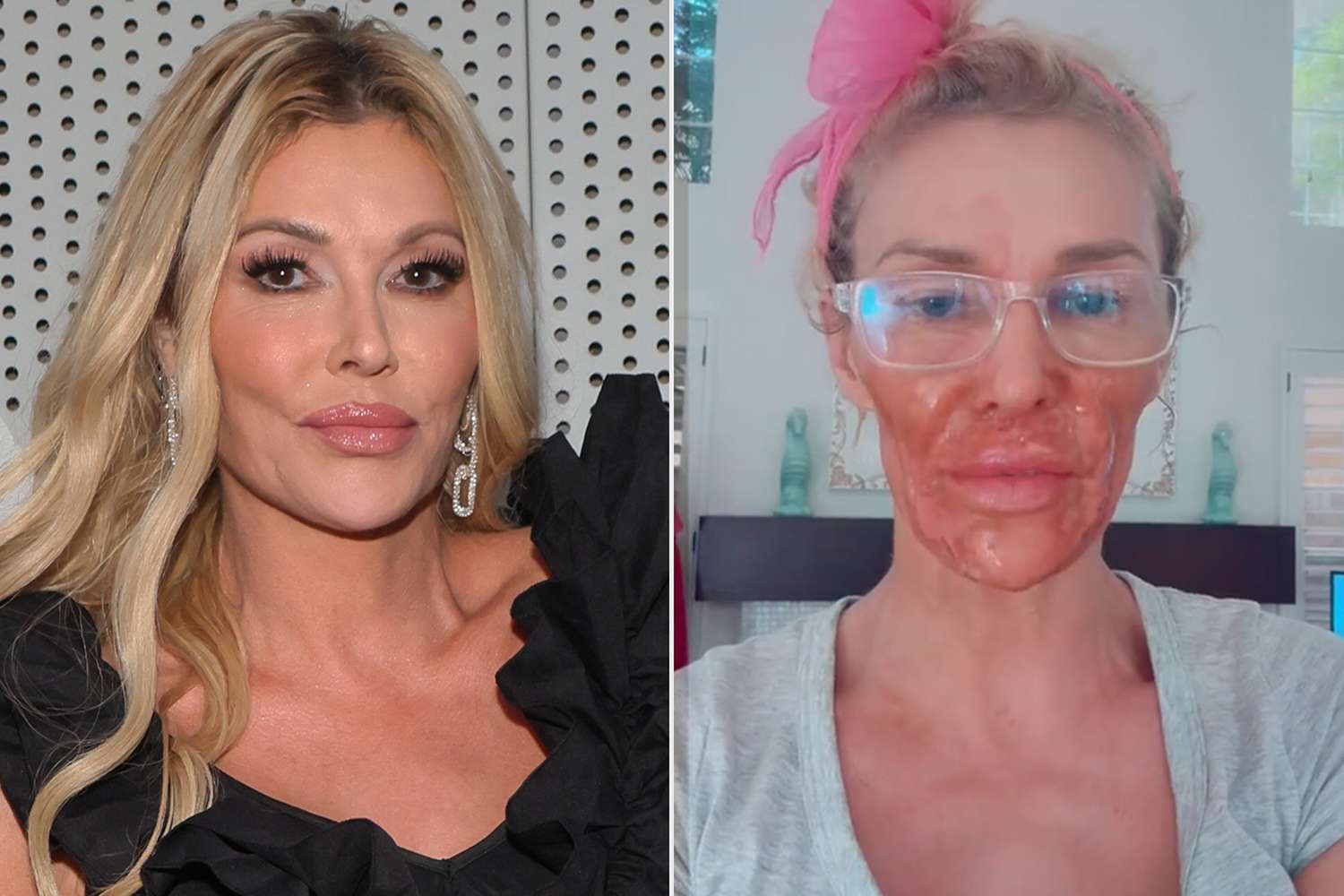 Former reality star Brandi Glanville spent over $113,000 treating a ...